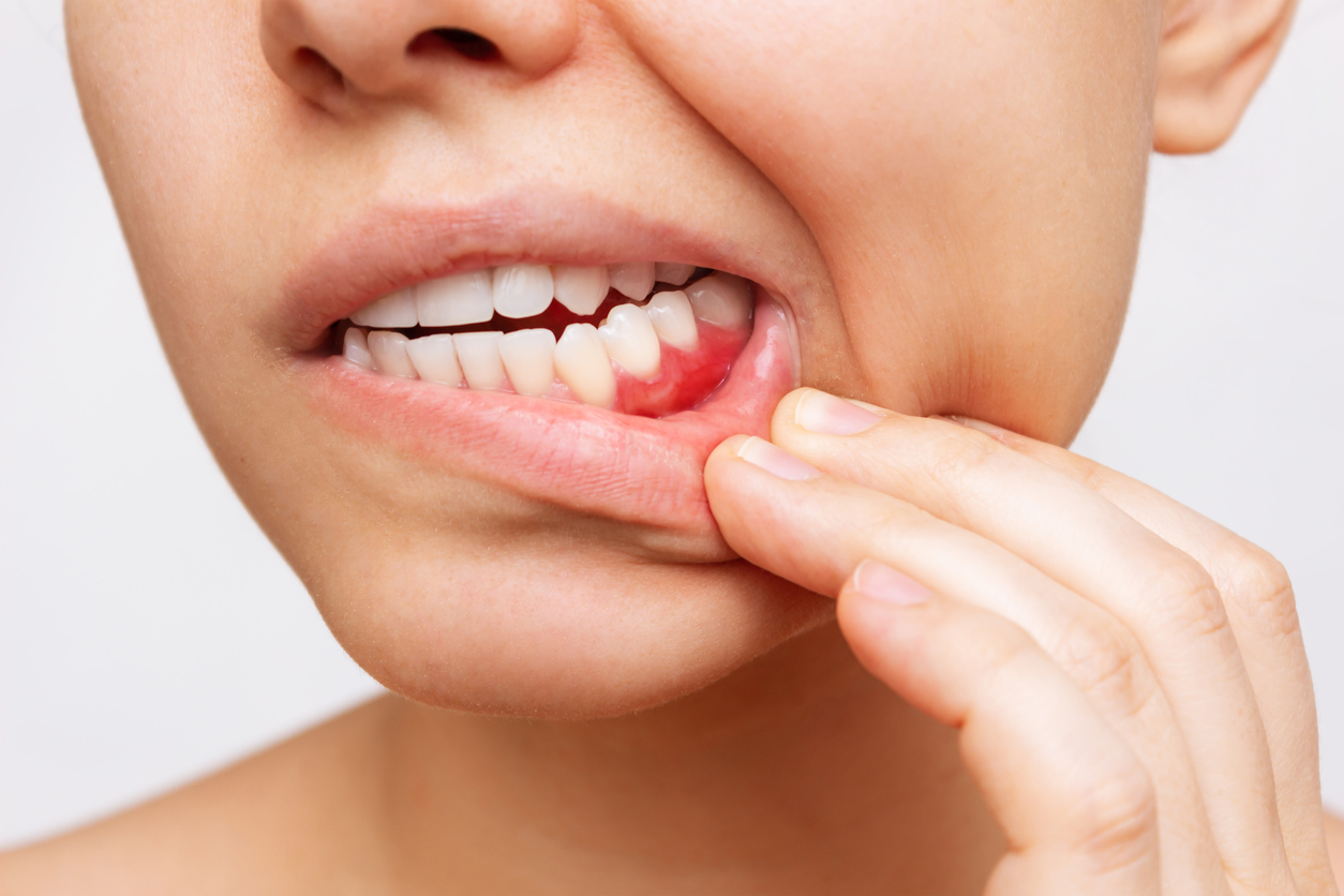 Recognizing Tooth Infection Signs And When To Seek Treatment